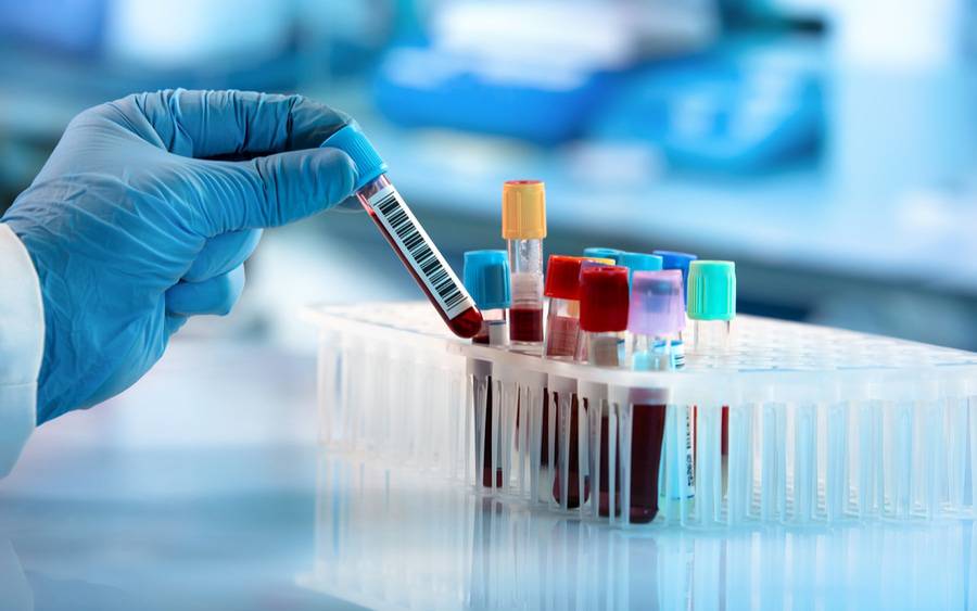 Other Tests Annai Theresa