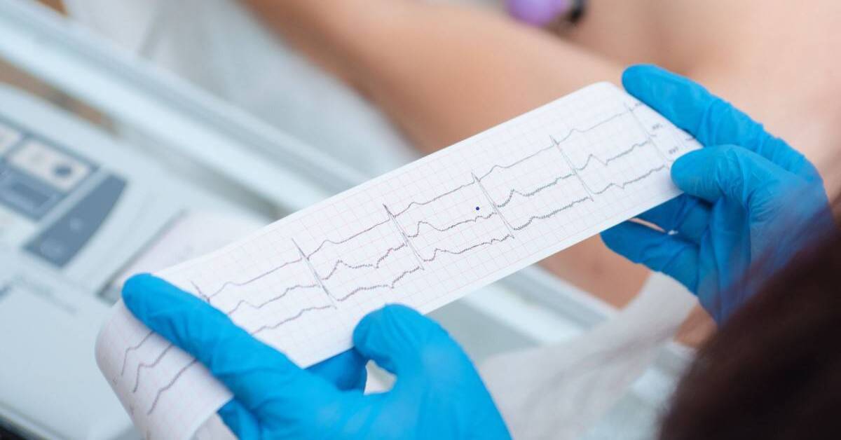 What Are Types of Catheter Ablation Procedures? - Scripps Health