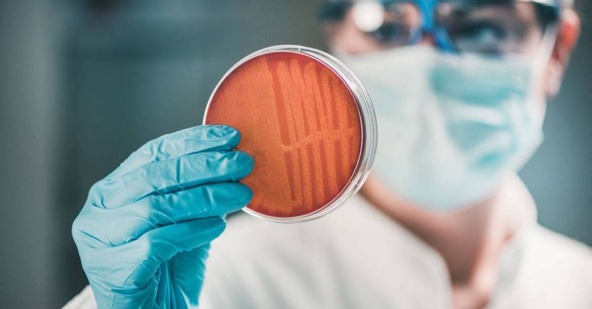 What to Know About MRSA Staph Infection - Scripps Health