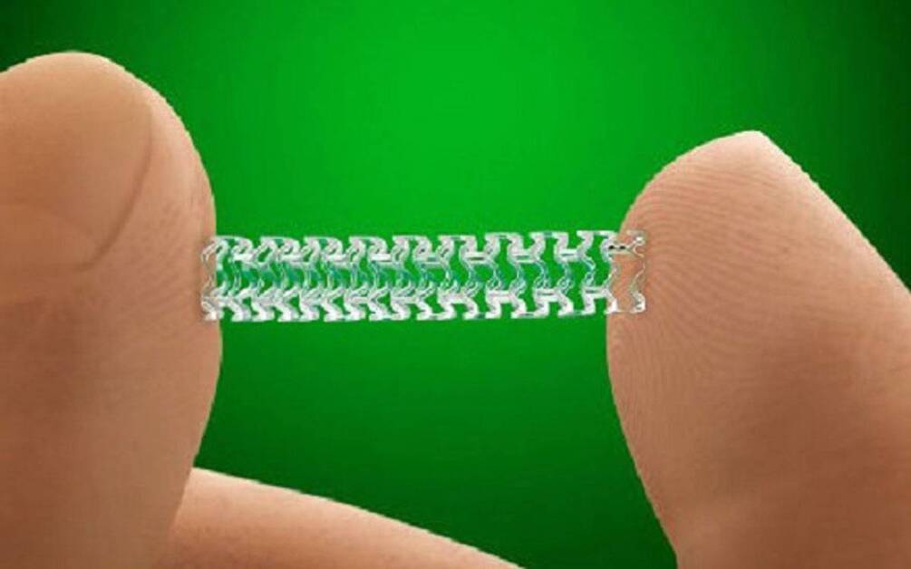 First in San Diego to Study Dissolvable Stent - Scripps Health