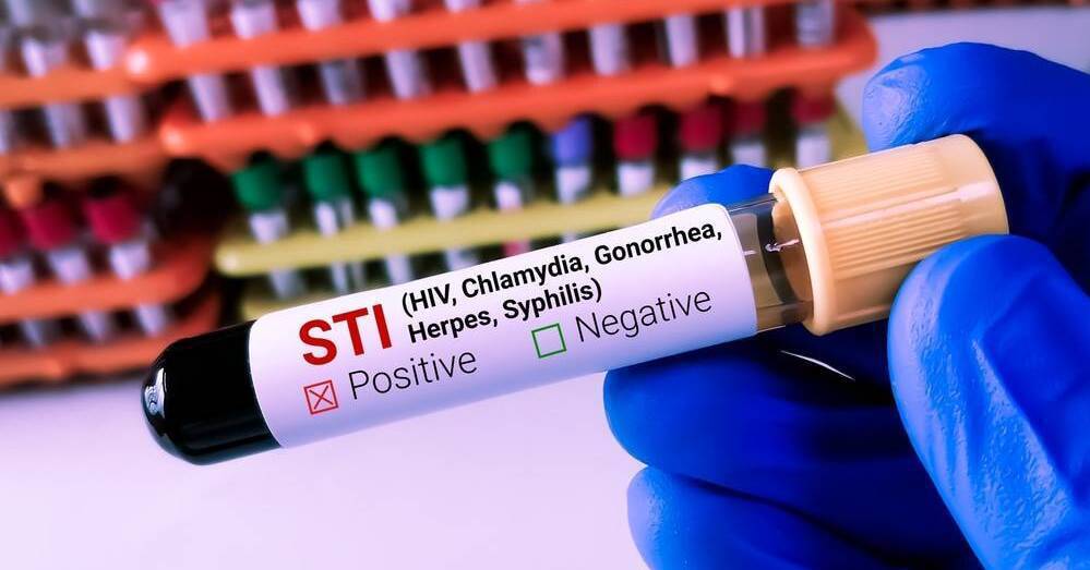 Play It Safe: STDs Are on the Rise - Scripps Health