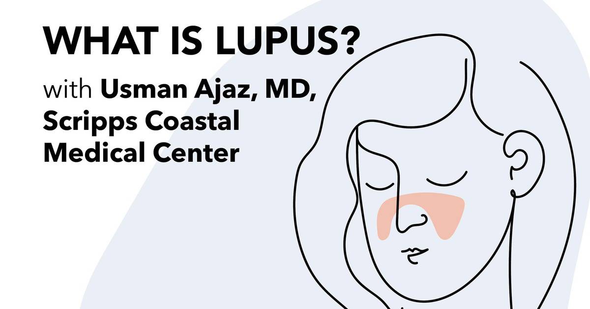 What Is Lupus? Symptoms, Diagnosis and Treatment - Scripps Health