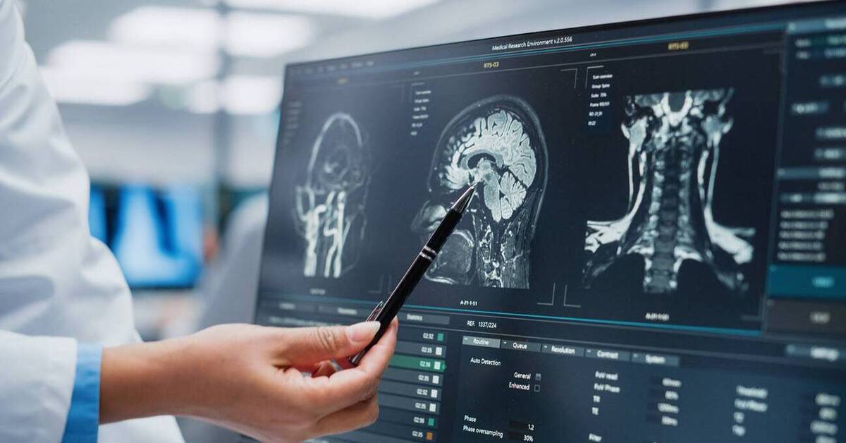 Neurology - San Diego - Scripps Health