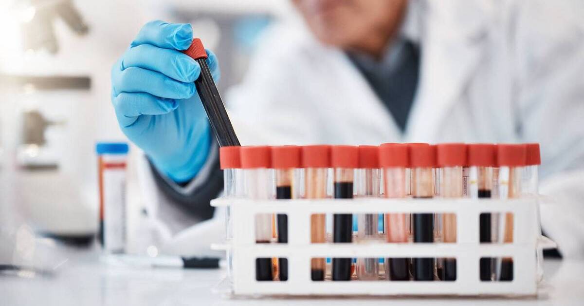 Blood Tests and Labs in San Diego - Scripps Health